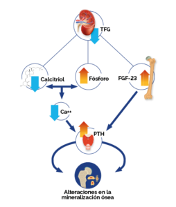 Equilibrio Renal | Alteración óseo mineral en la ERC-2